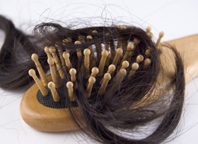 Implantul capilar: solutia moderna pentru caderea parului