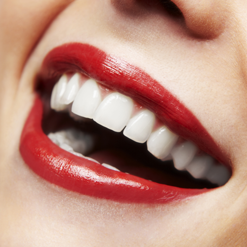 Albeşte-ţi dinţii fără durere! Alege laserul dentar