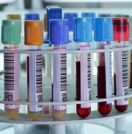 Un simplu test al sângelui ar putea diagnostica în curând 5 tipuri de ...