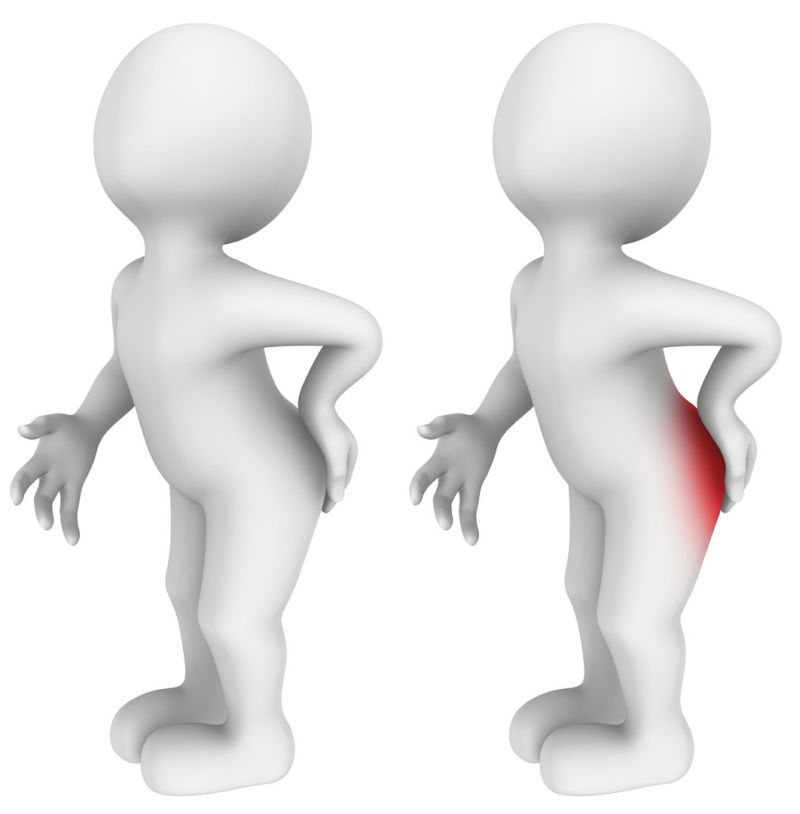 Hemoroizii: simptome, tratament