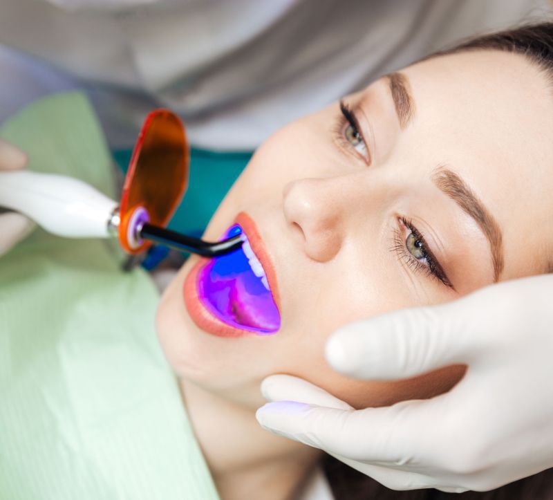 Tratament cu laser pentru parodontoză: avantaje şi recomandări