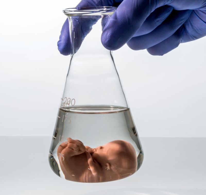 Fertilizare in vitro cu ICSI