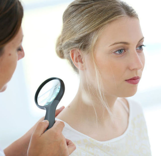 De ce nu este bine să îndepărtăm singuri negii şi papiloamele