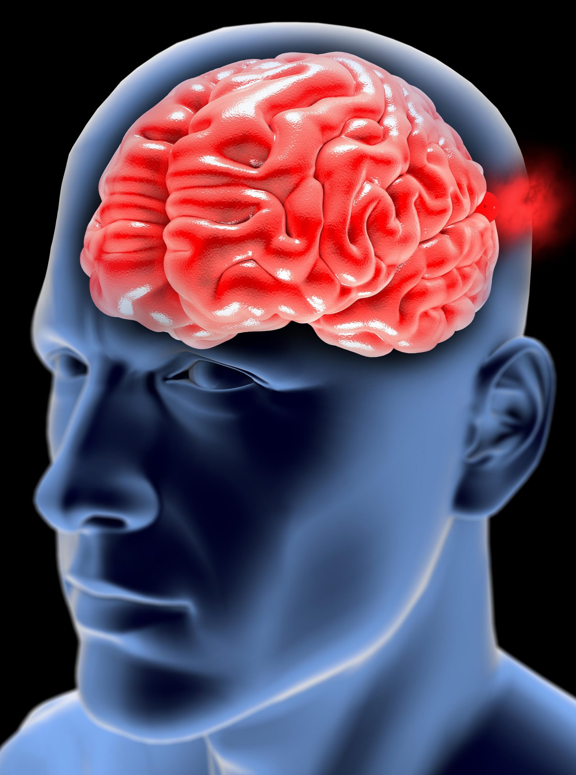 Anevrismul: diagnostic şi tratament