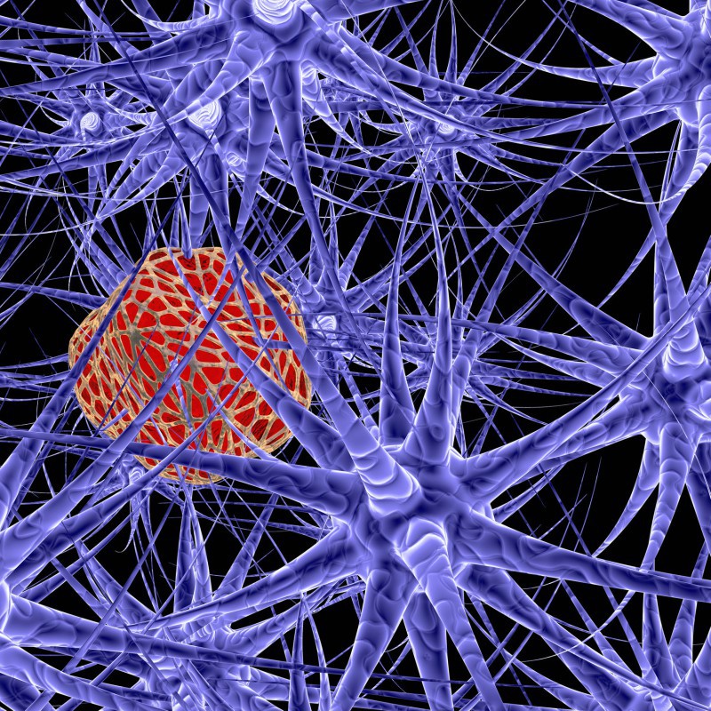 Neuroblastom: definiţie, cauze, simptome, tratament