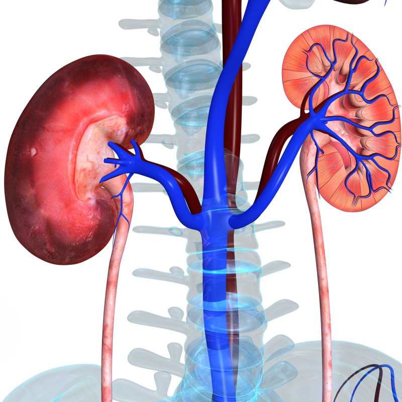 Cancer renal: simptome, cauze, tratament, prevenţie