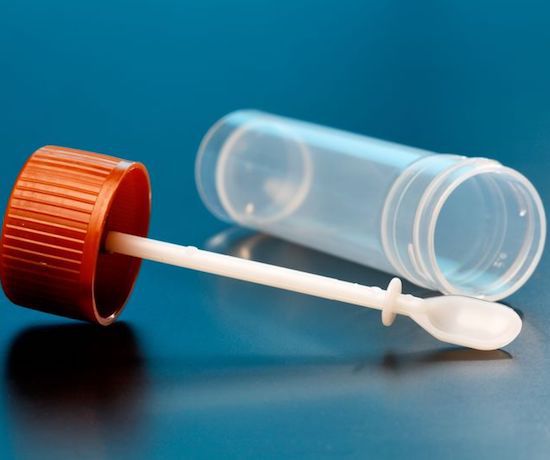 Examenul coproparazitologic: când se recomandă