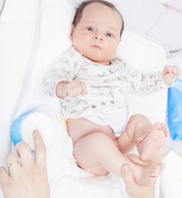 Eritemul fesier la copii: cauze, simptome, tratament