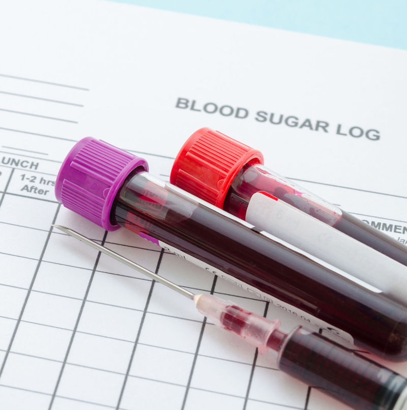 Dr. Antoanela Curici: analize şi teste în diabet VIDEO by CSID