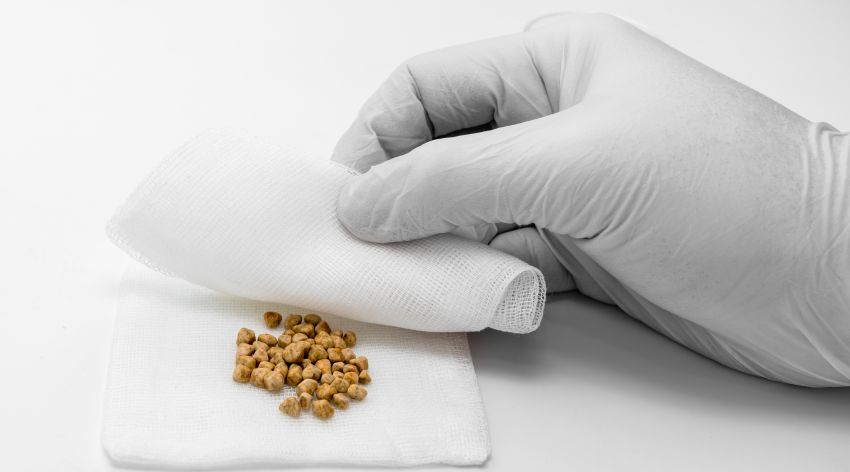 Pietre la colecist - simptome, regim alimentar, când e nevoie de ...