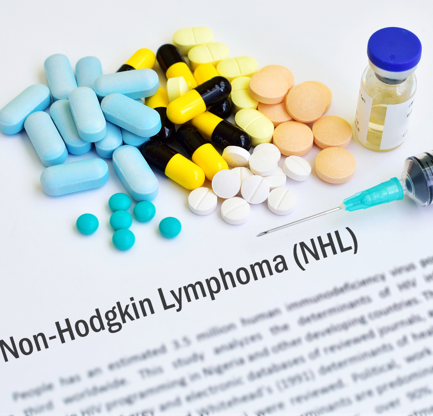 Limfom non-Hodgkin - circa 1 din 50 de oameni va face o formă a acestei ...