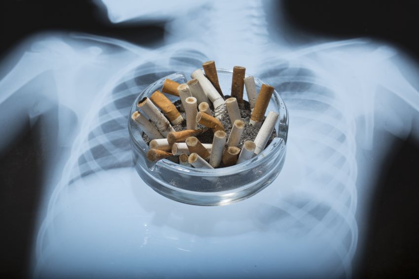 Analiza pe care toți fumătorii trebuie să o facă după 50 de ani