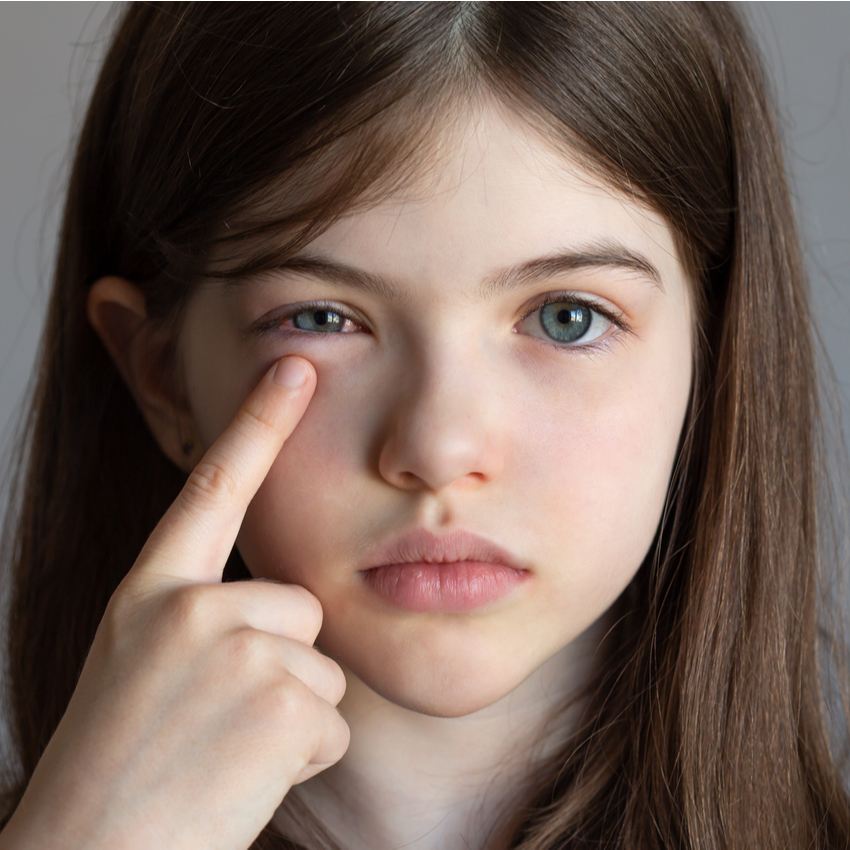 Ochi umflați din cauza alergiilor: cum să previi și să tratezi