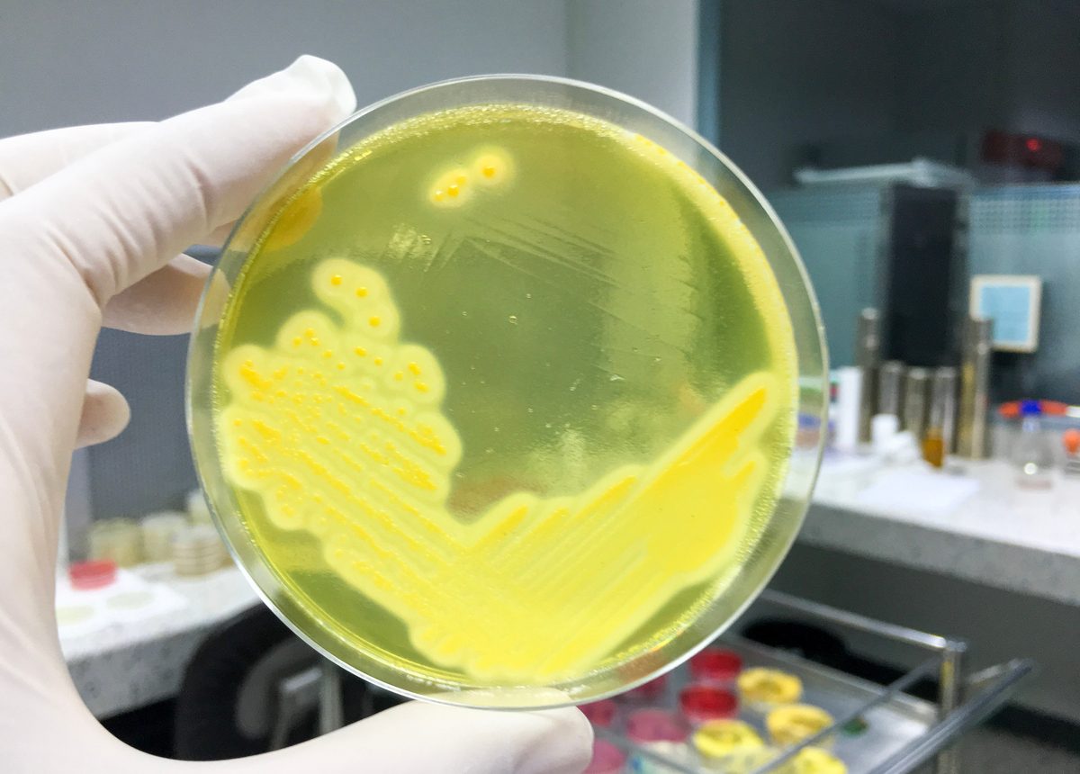 Staphylococcus aureus (stafilococul auriu) - ce este, ce simptome apar ...