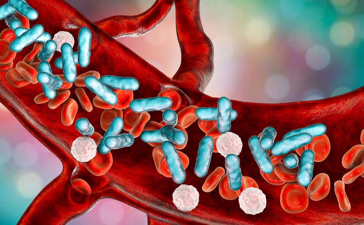 Infecție în sânge (sepsis) - analize, cauze, simptome și tratament