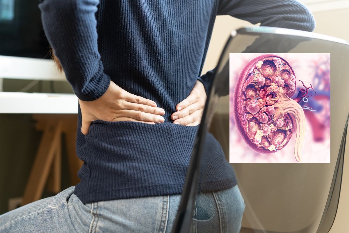 Obiceiul care îți distruge rinichii. Toată lumea face această greșeală