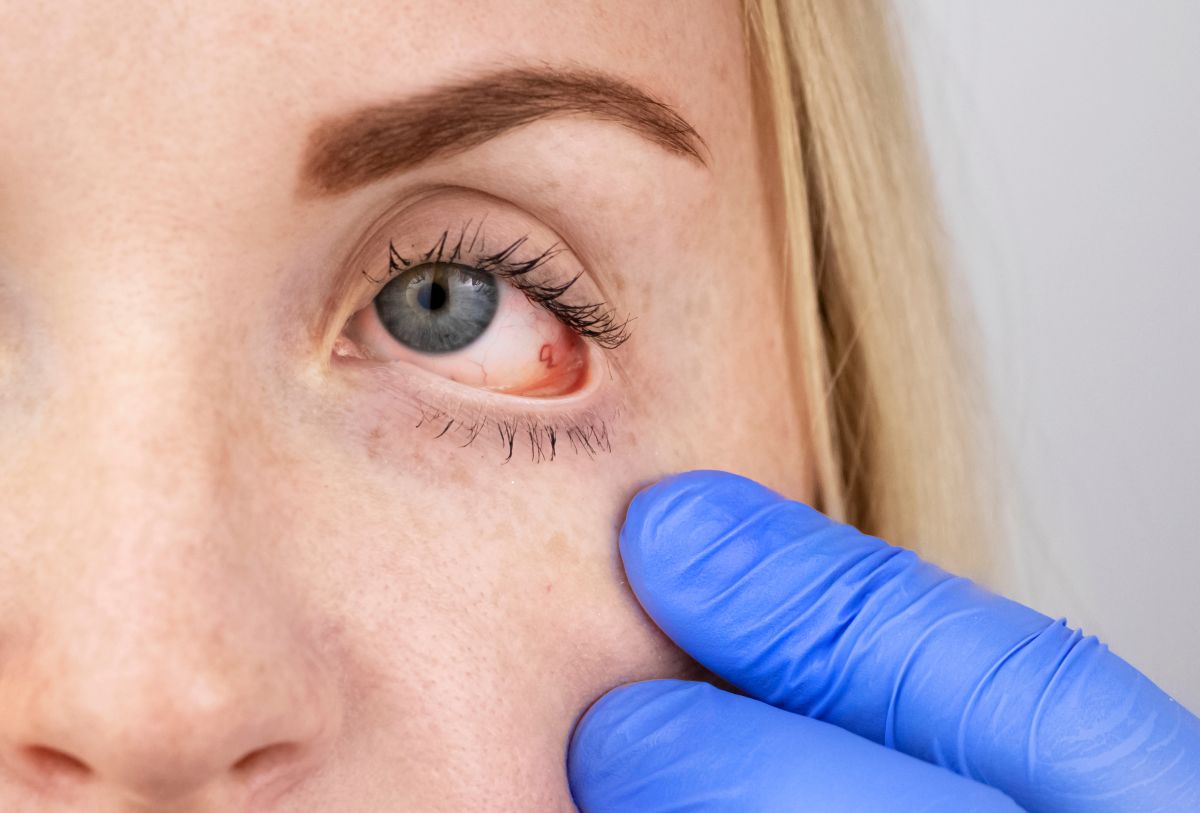 Nu risca să rămâi fără vedere! Ce trebuie să faci dacă îți intră ceva ...