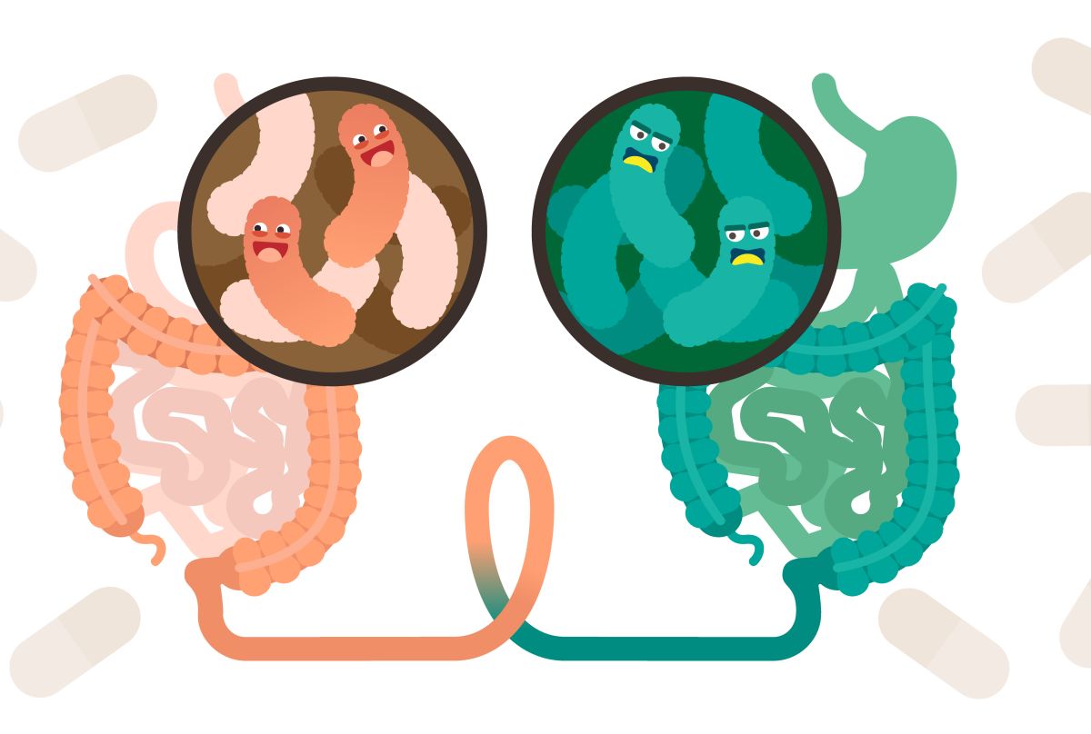 Transplantul de fecale, eficient în vindecarea infecției cu Clostridium ...