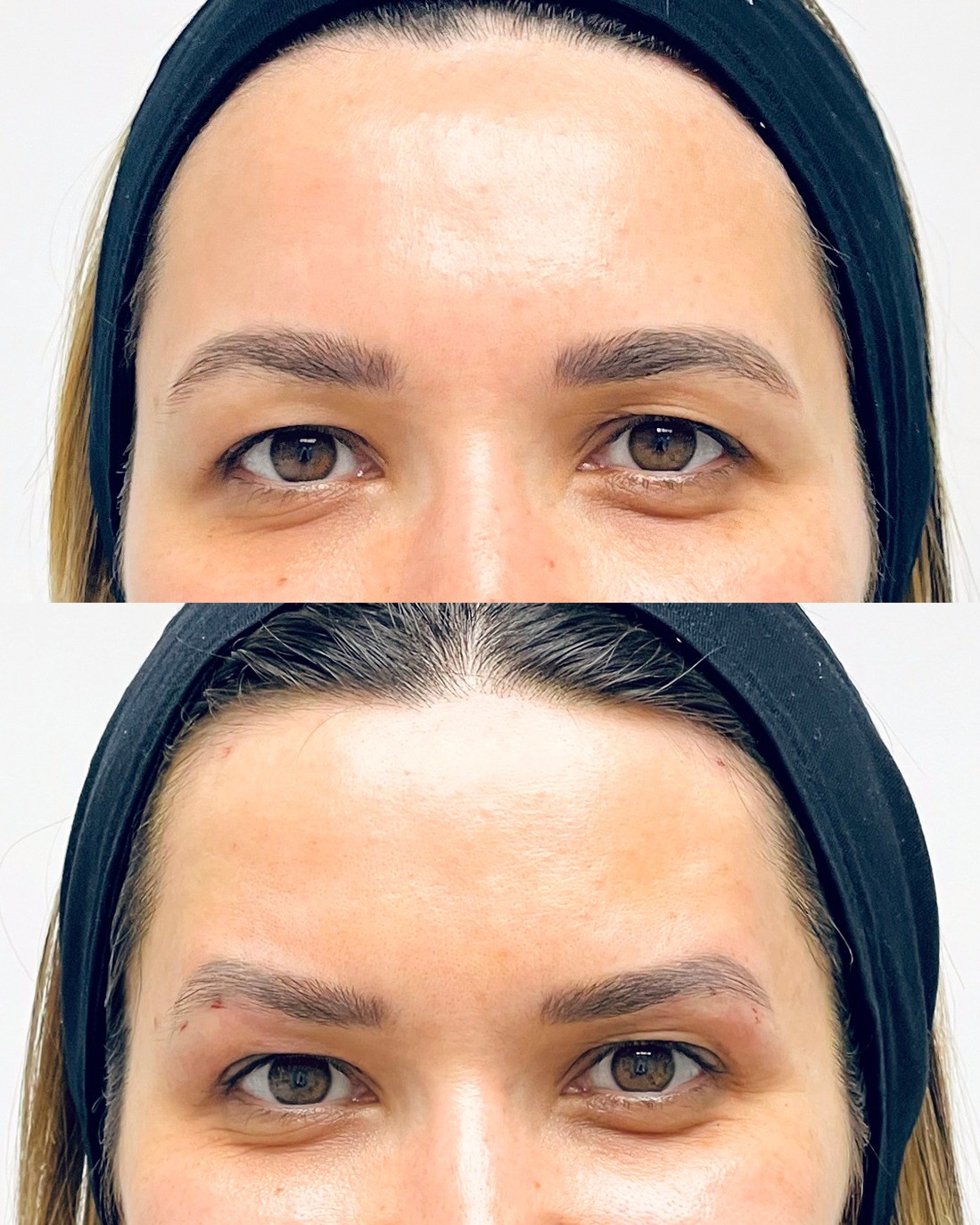 Lifting de sprâncene, un nou trend printre vedete. Vezi cât costă