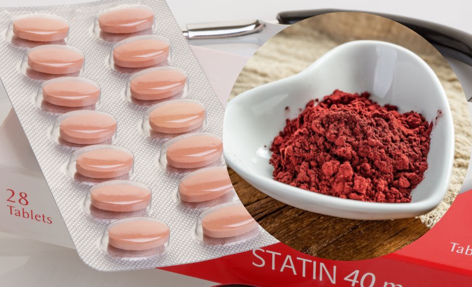 Cea mai eficientă metodă pentru scăderea colesterolului: statine ...