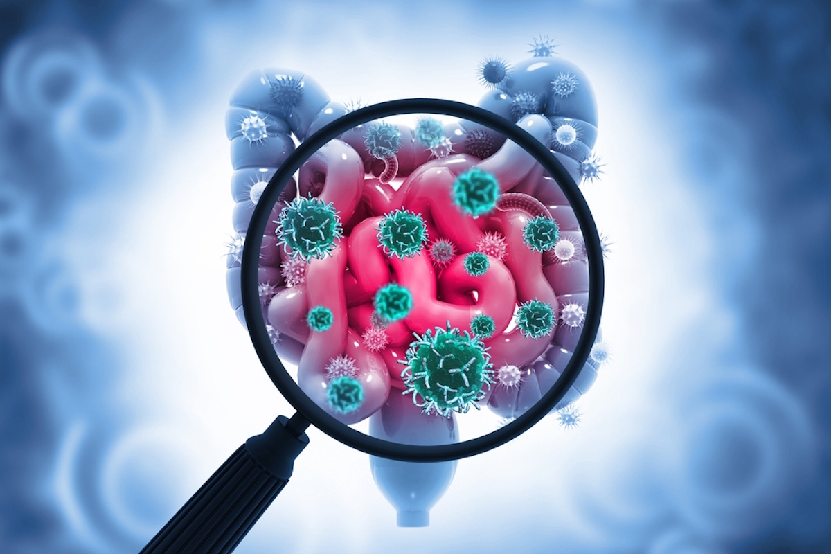 Cum apar de fapt metastazele și cum se pot trata?