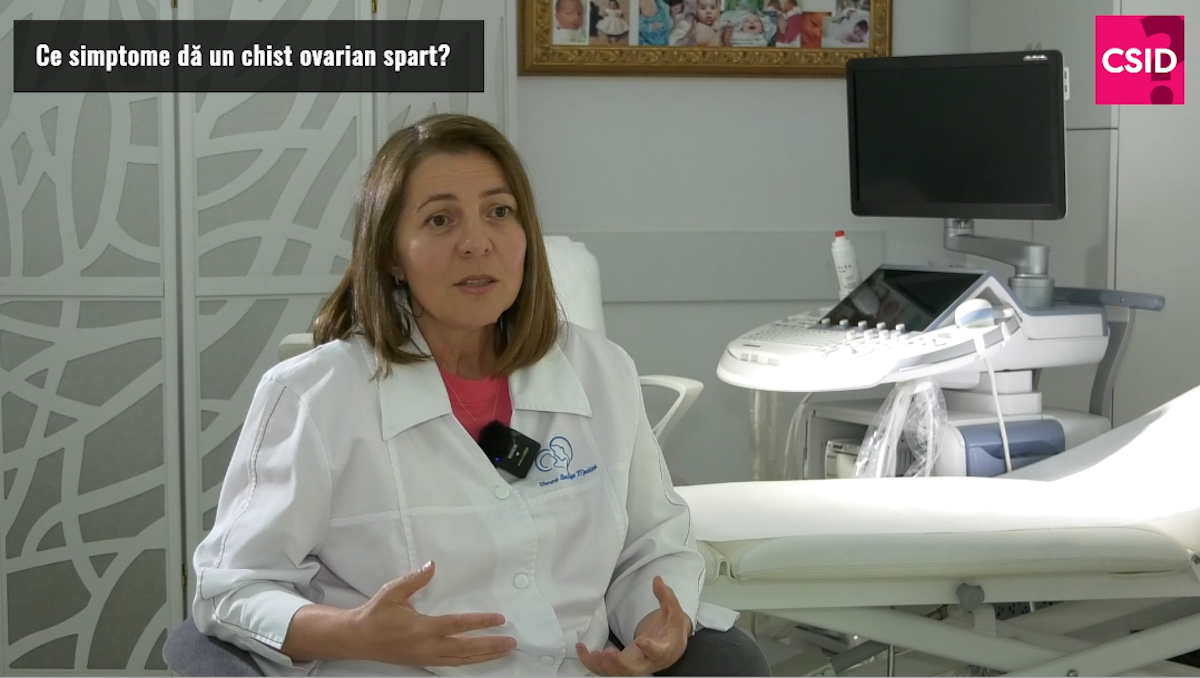 Ce simptome dă un chist ovarian spart?