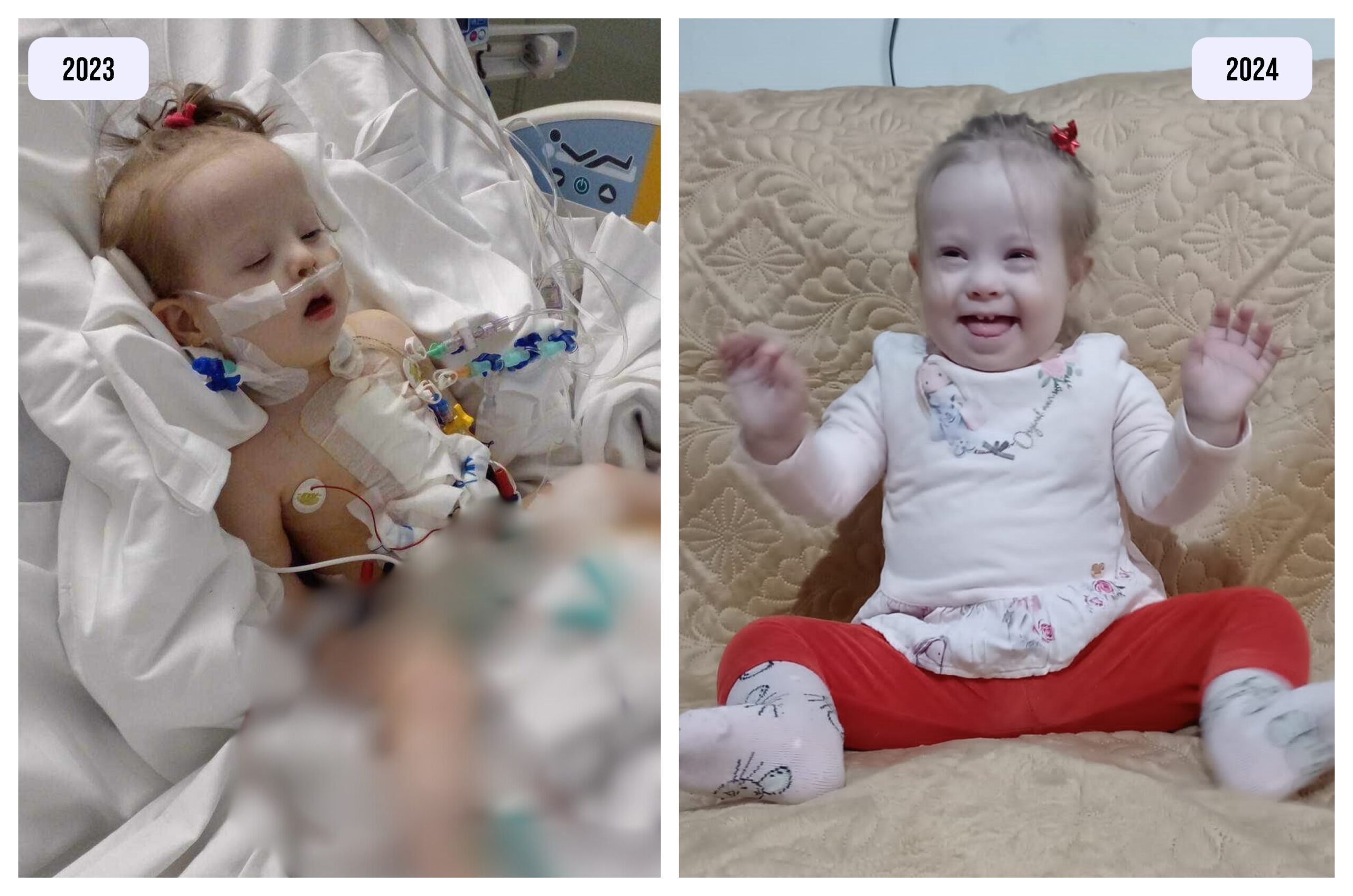 Măriuța avea două găuri în inimă. La un an de la operație, copila din ...