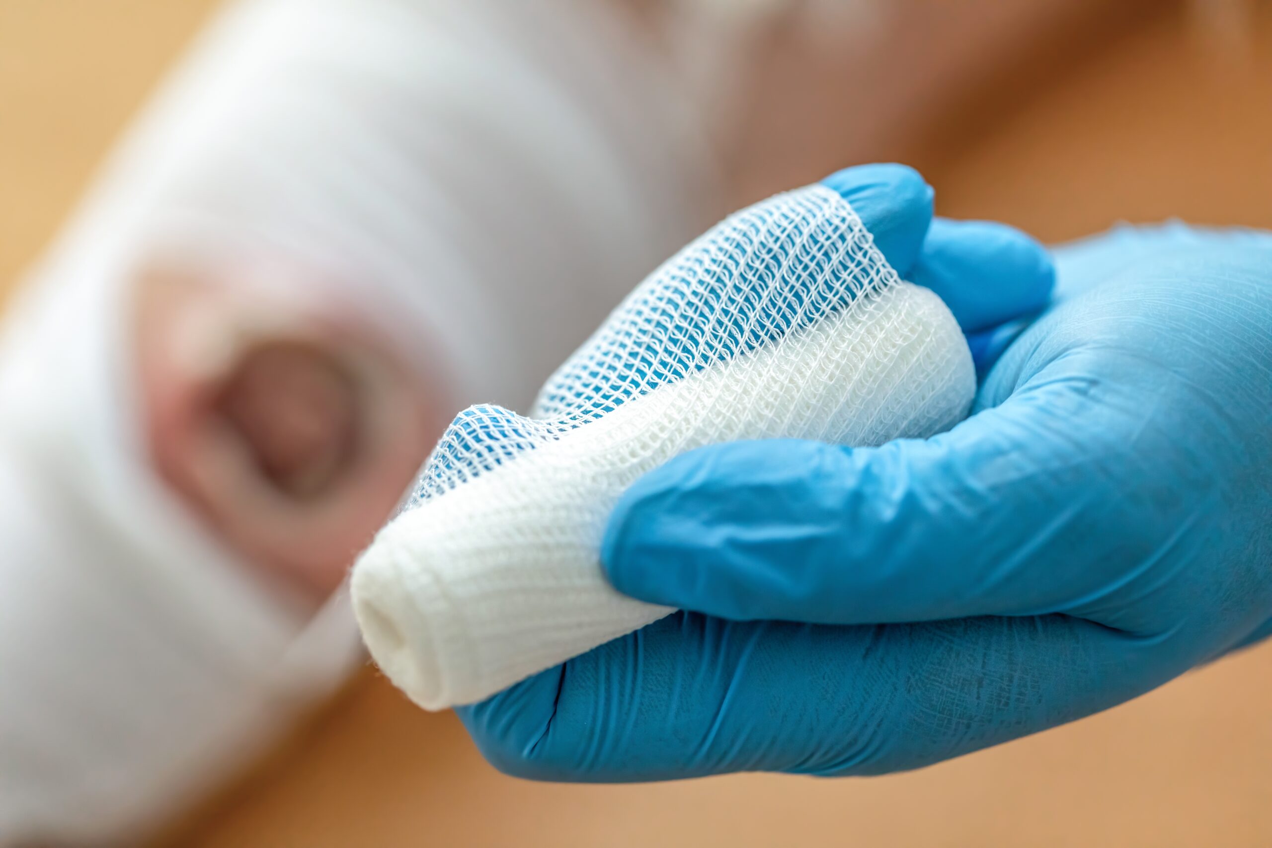 Gestionarea tratamentului ulcerului venos - Experiența asistentei ...