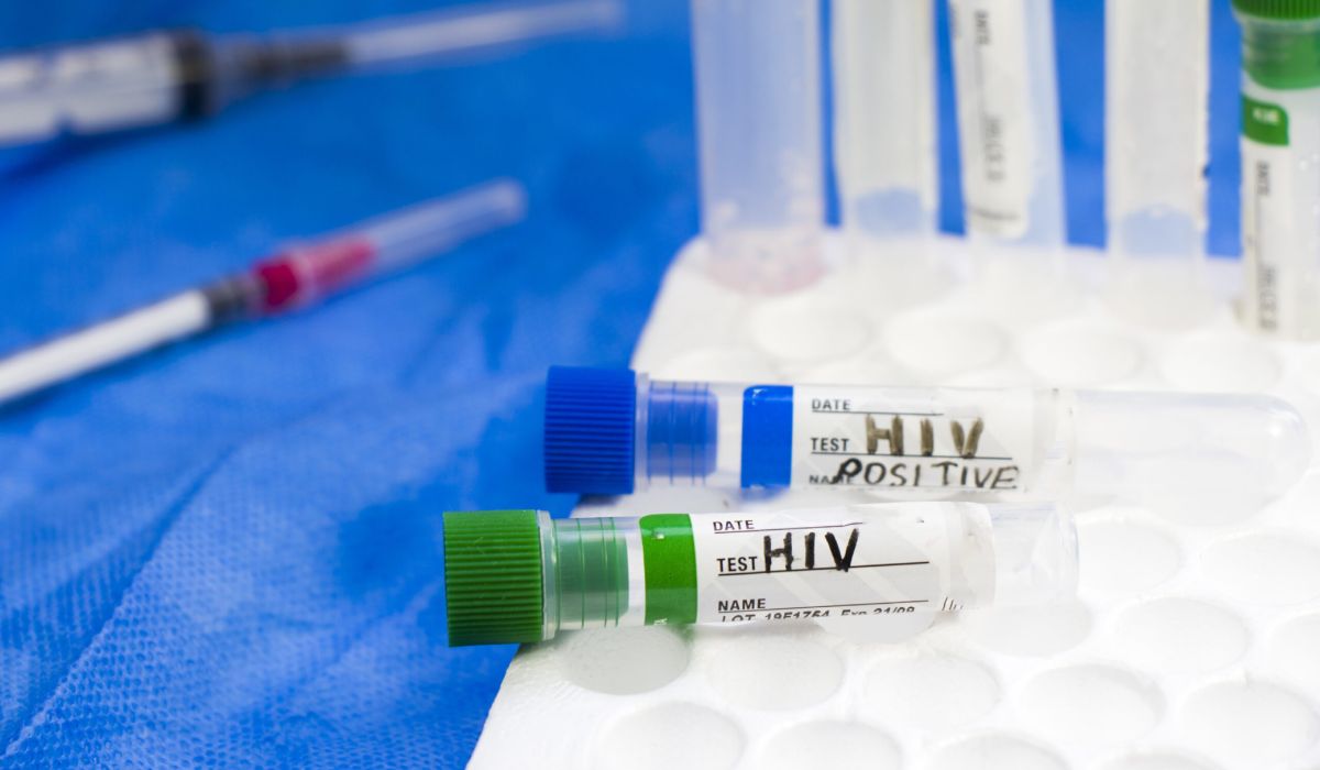 Pacient cu HIV, vindecat după un transplant de celule stem! Cazul a ...