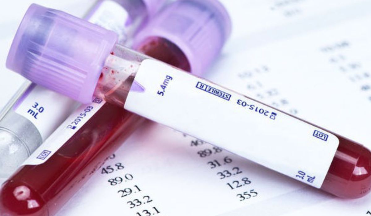 Ce conține un set complet de analize și care sunt cele mai importante ...