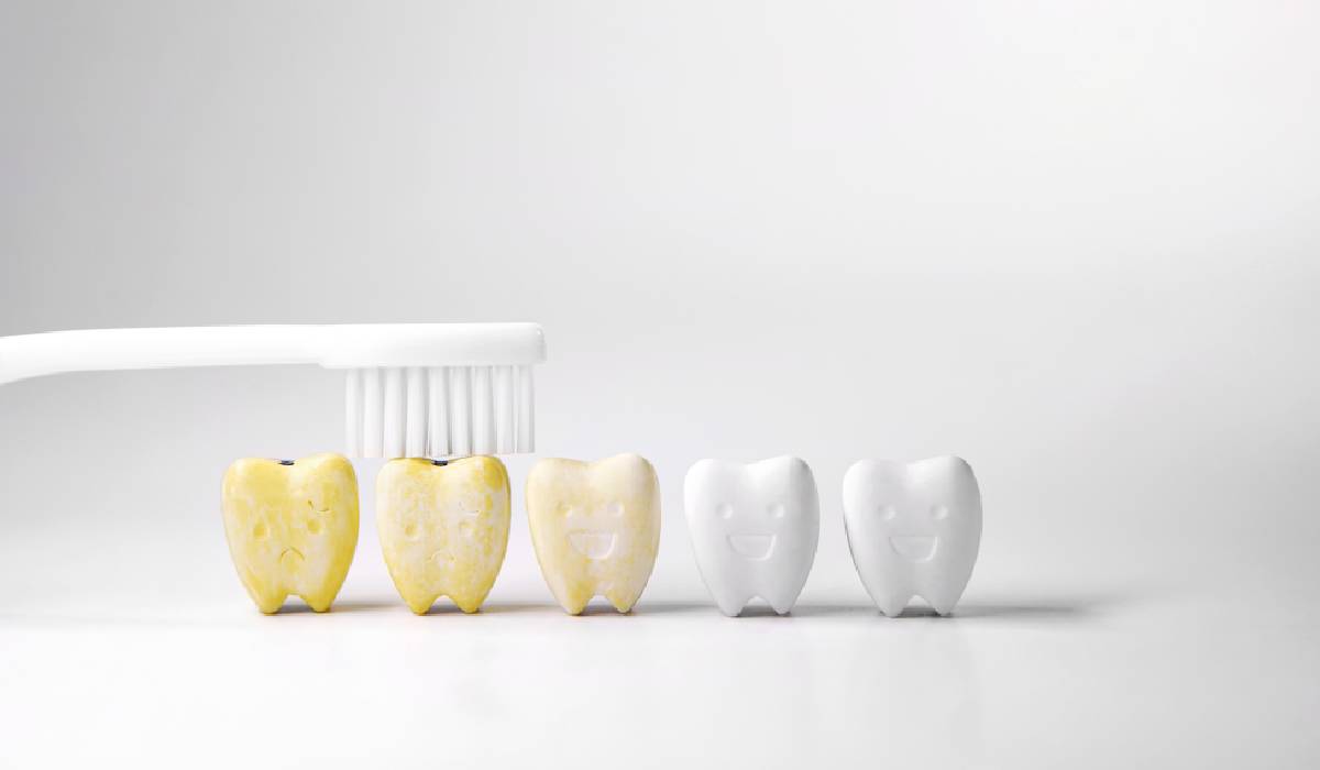 10 cele mai dăunătoare alimente pentru dinți la care nu te-ai gândit