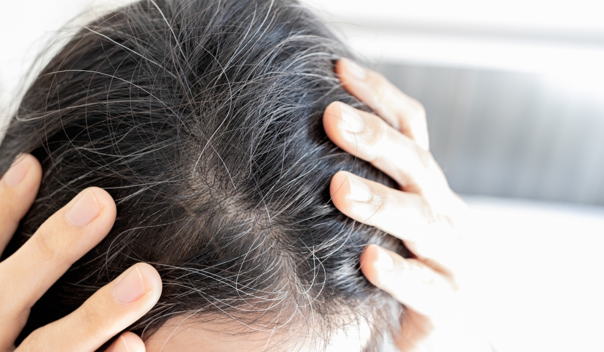 Adio fire albe! Serul negru care oprește albirea și accelerează ...